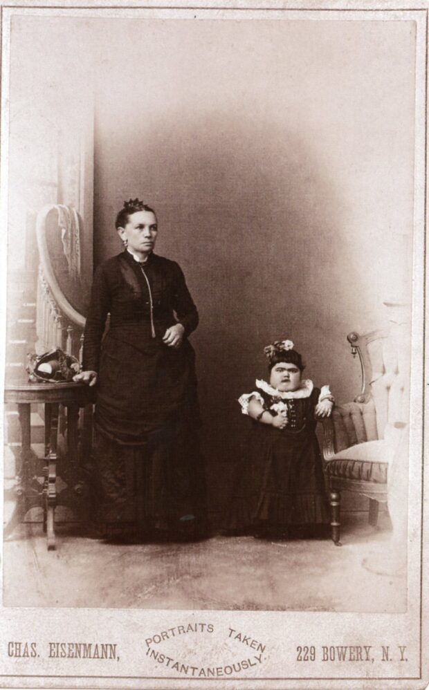 Freaks – Morbid Fact Du Jour!